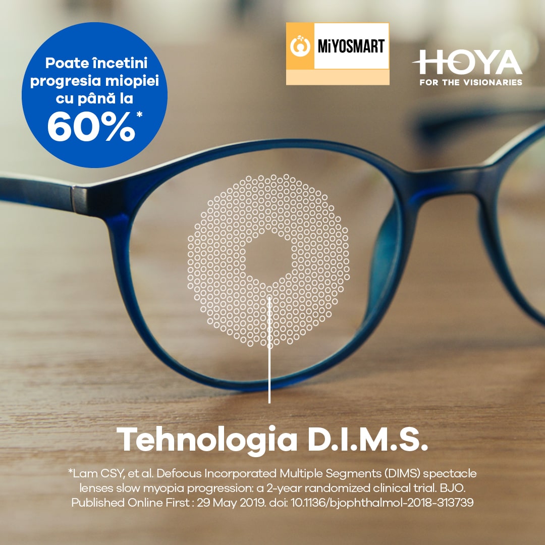 Lentile MiYOSMART - iris-optic.ro